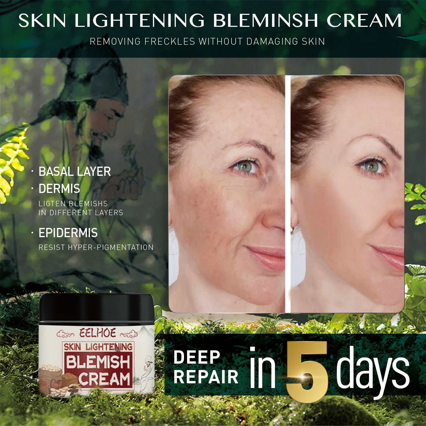 melasma and pekas remover cream original krina melasma pills tablet ...