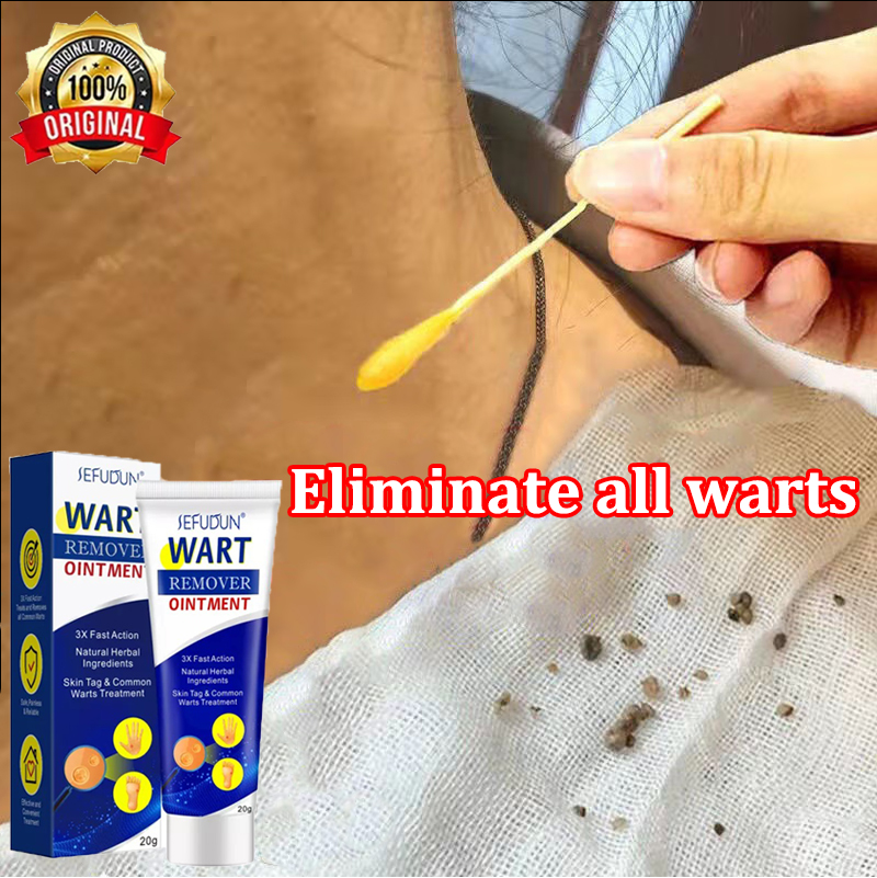 【SEFUDLN】Wart Removal Cream warts remover original cream painless Mole ...