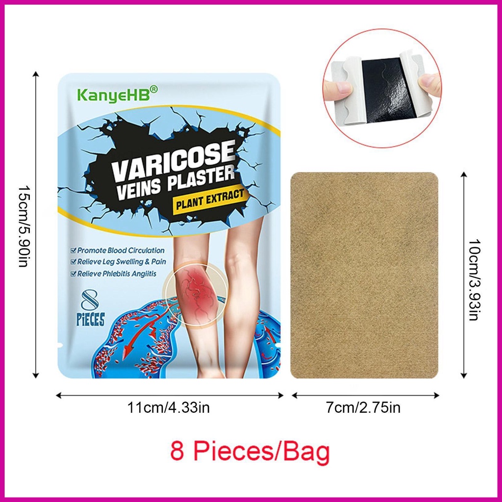 KanyeHB varicose vein removal cream varicose veins Plaster Patch ...