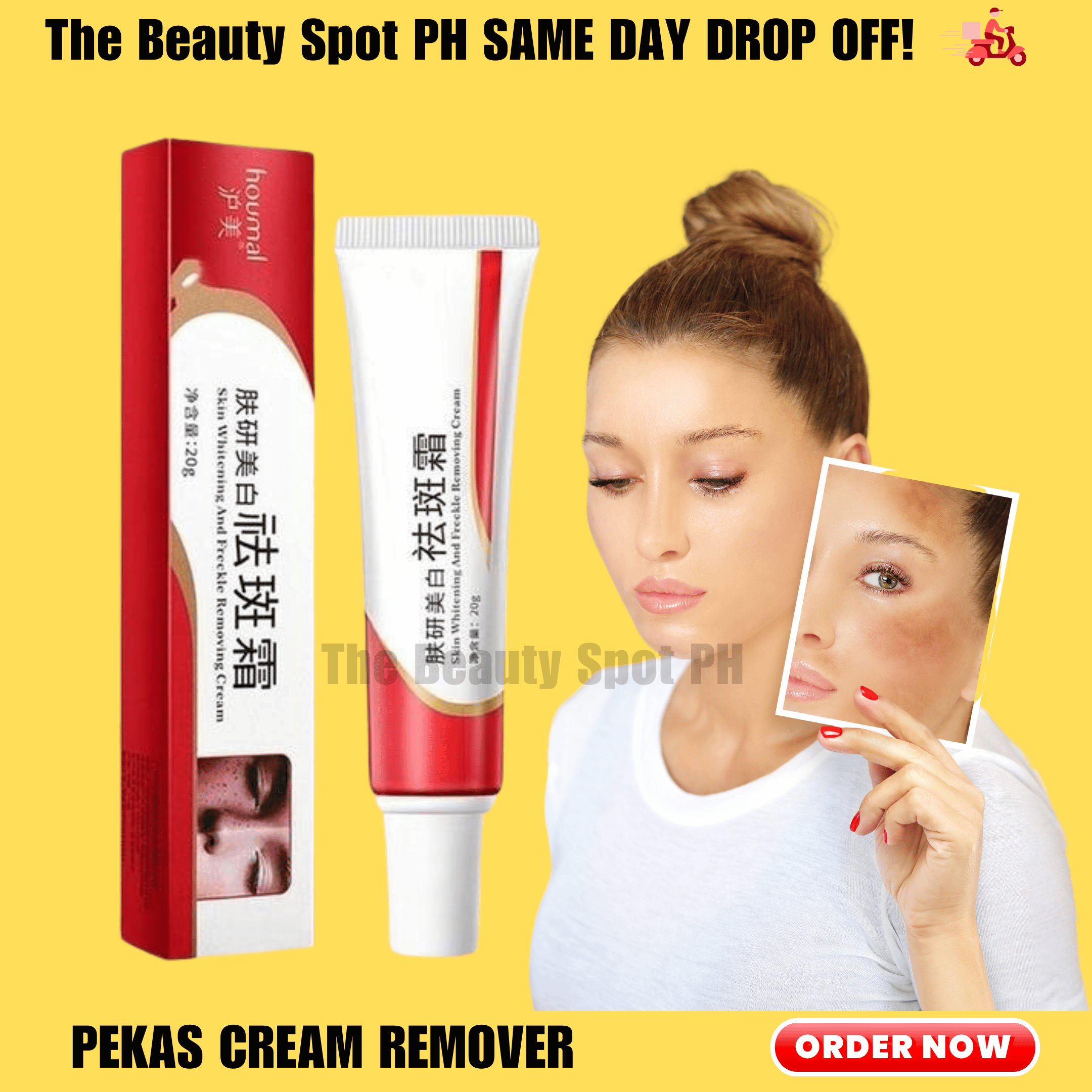 ORIGINALPekas and Melasma Cream - Original Formula for Very Effective ...
