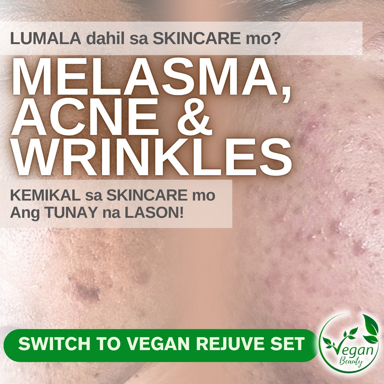 Vegan Beauty Rejuvenating Skincare Set | Lazada PH