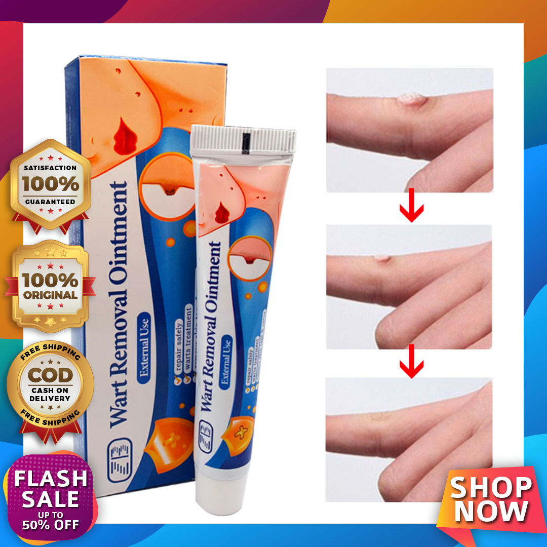 Top Sale Original COD 20g Warts Remover Ointment Wart Treatment Corn ...