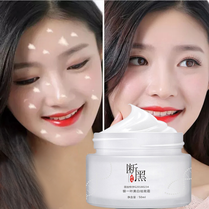Fast effective freckle removal whitening cream with vitamin c ...