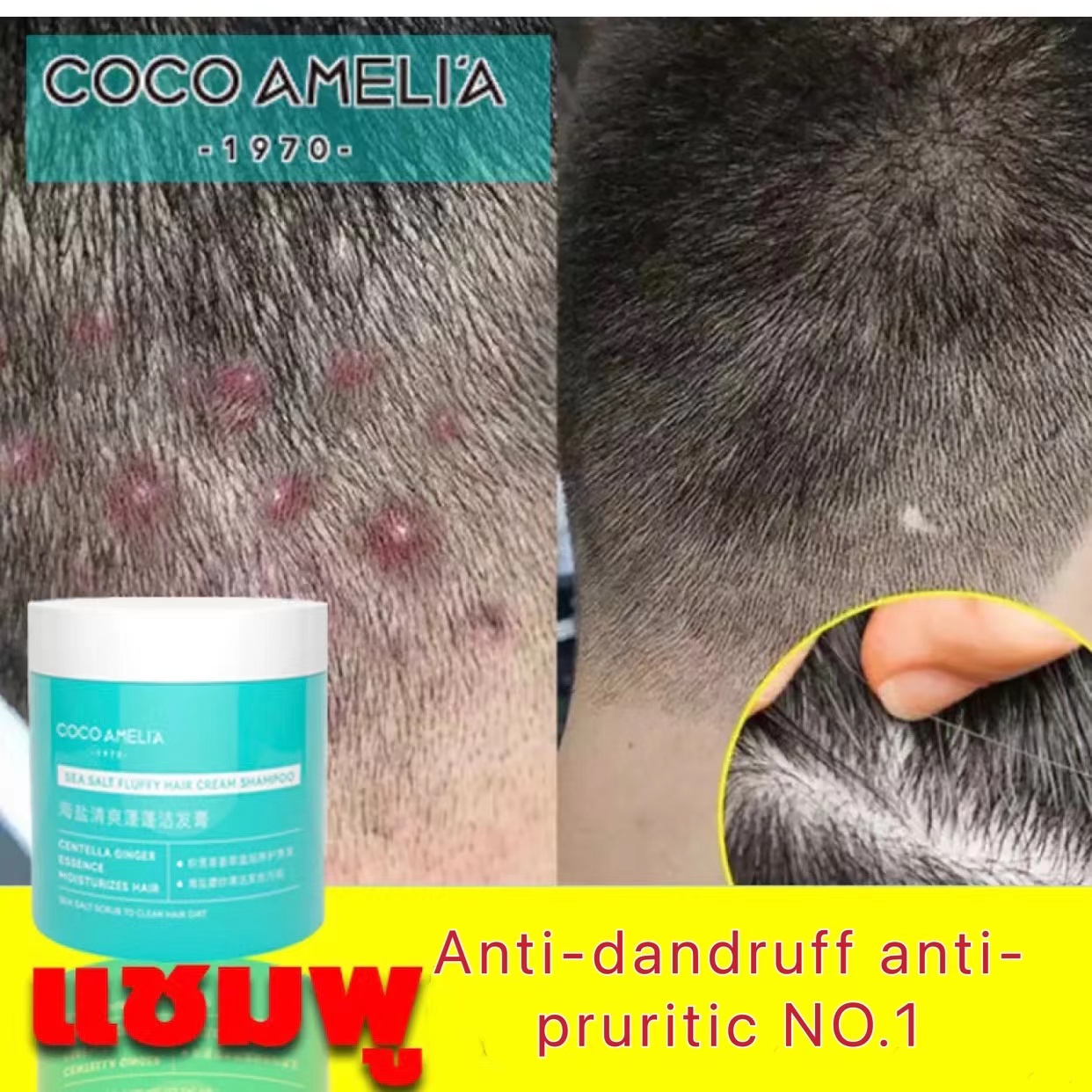 CCA Sea Salt Shampoo 250g Deeply Clean The Scalp Reduce Dandruff ...