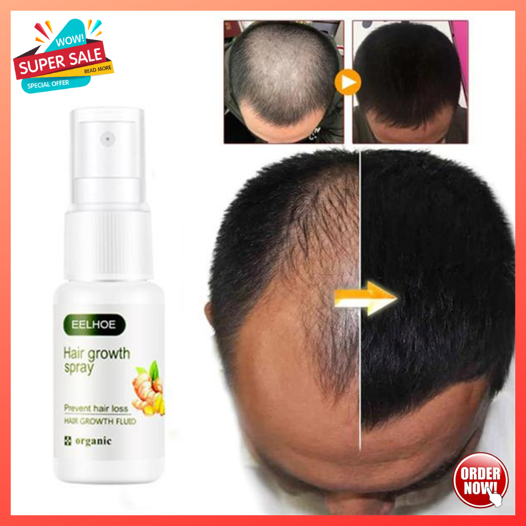 SUPER EFFECTIVE !! Regrowth Ginger Spray Fast Hair Growth Fluid Anti ...