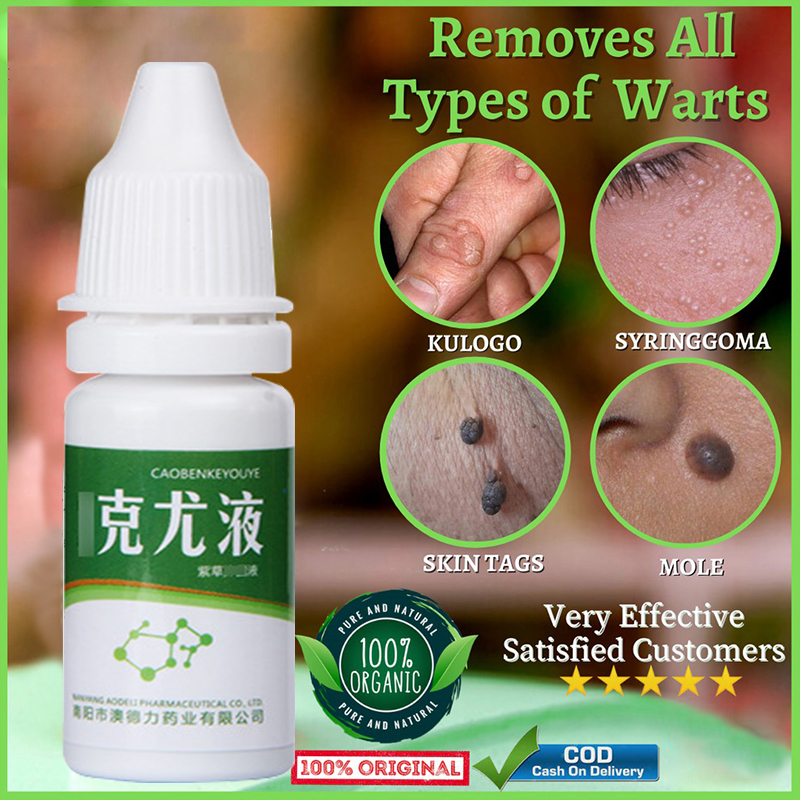 Warts Remover Original Liquid Warts Magic Remover Wart Ointment ...