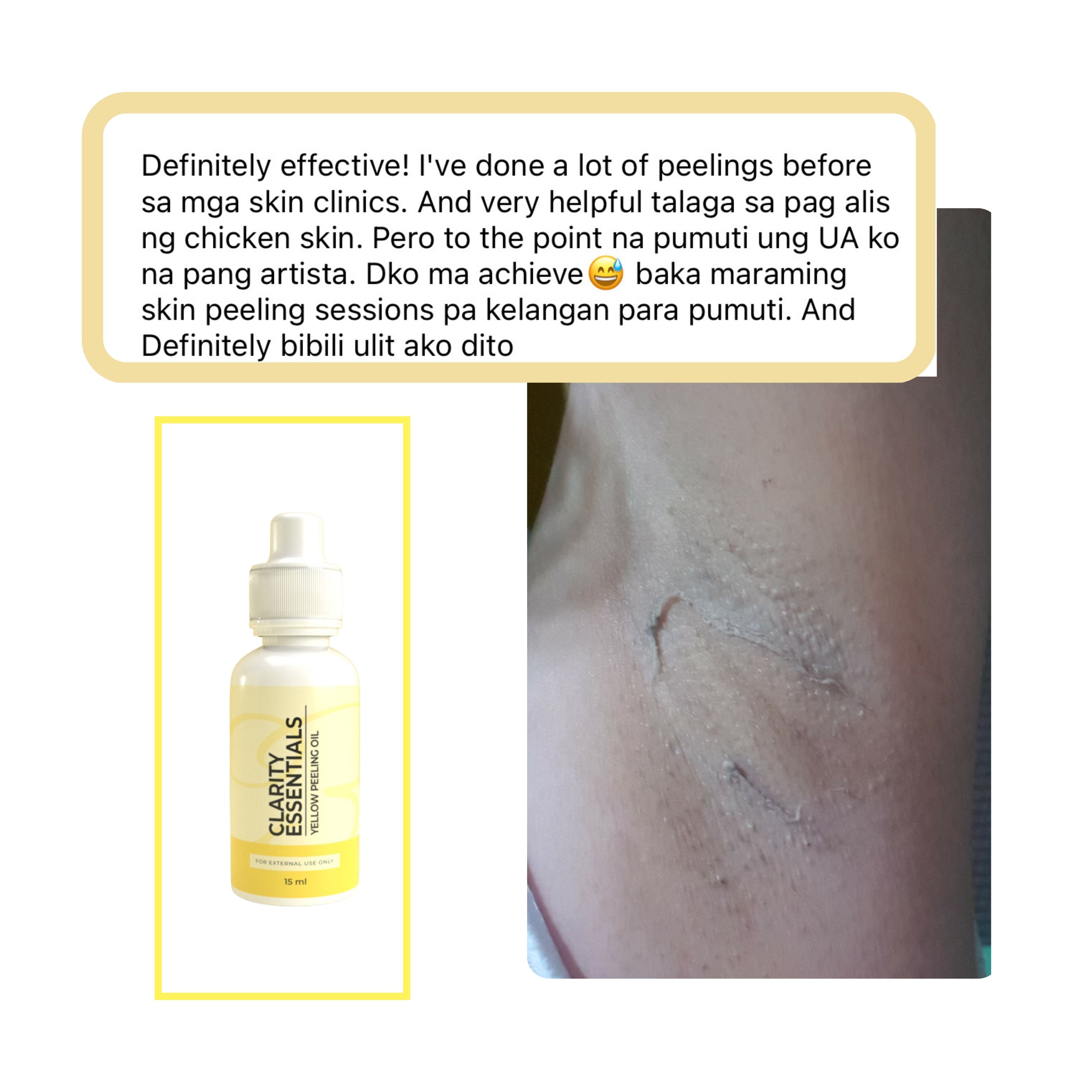 Yellow Peeling Oil 15ml | Underarm Peeling | Face Peeling | Skin ...