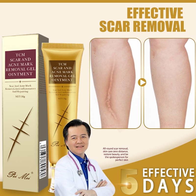 Fix Scar Removal Original Scar acne scars remover for old scars face ...
