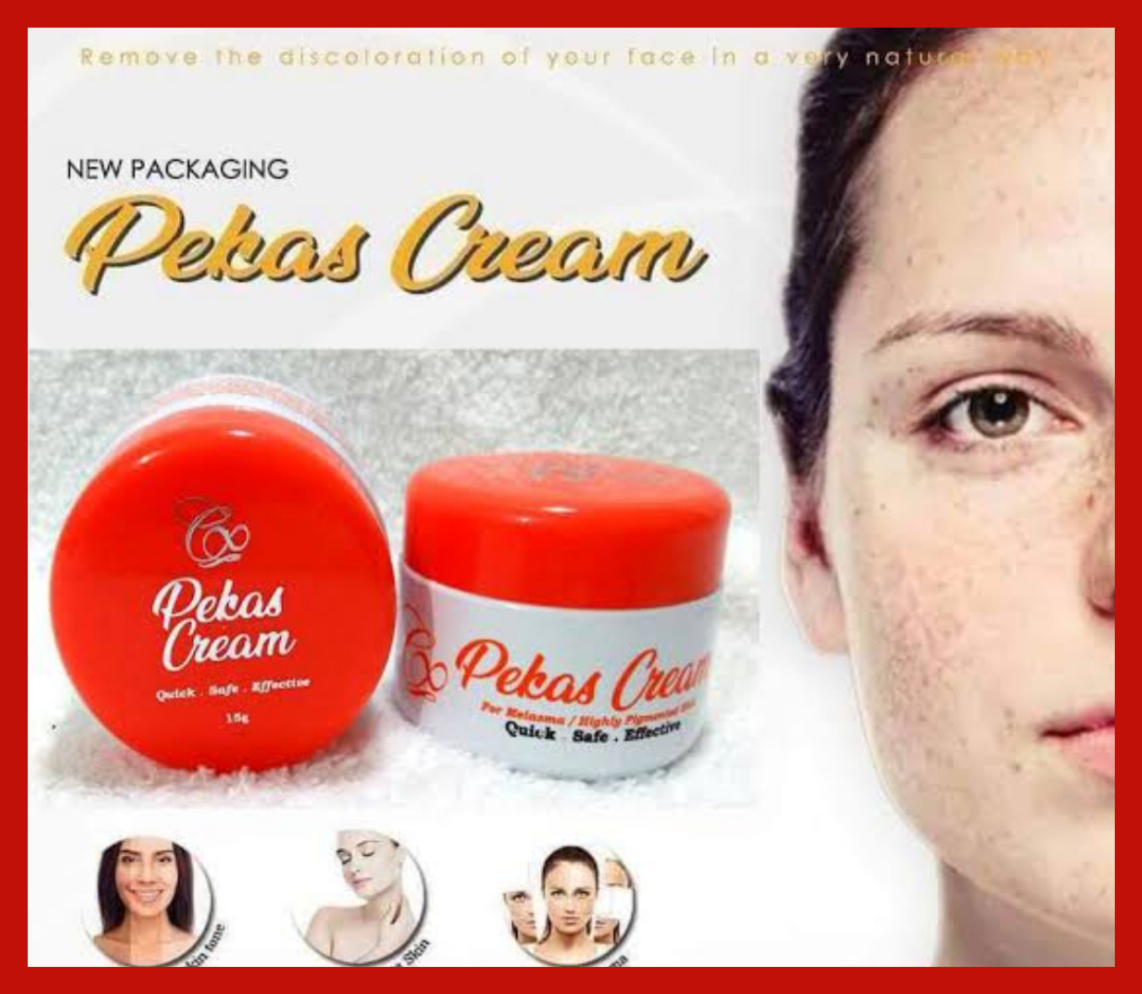 Pekas Removal Cream for Melasma / Highly Pigmented Skin 15G | Lazada PH