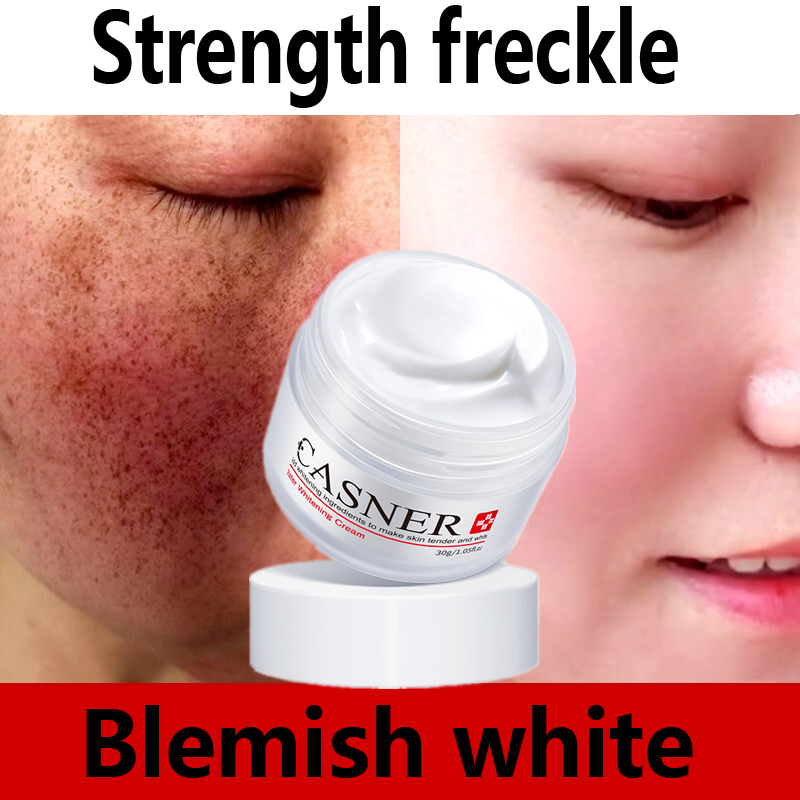 Whitening freckle removal cream original dark spot remover Dark Spot ...