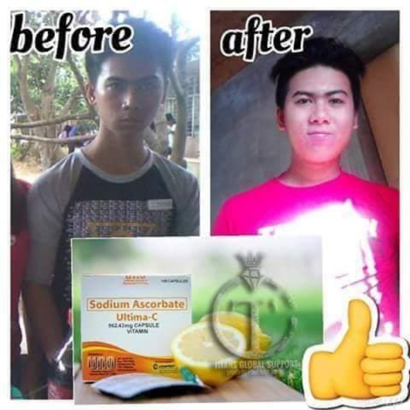 ULTIMA C 30 CAPSULE, VITAMINS NA PAMPATABA, SAFE AND EFFECTIVE Sodium ...