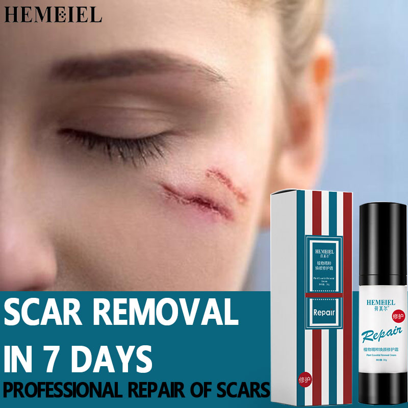HEMEIEL Scar Remover/Scar Remover For Old Scar On Leg/Acne Scar Remover ...