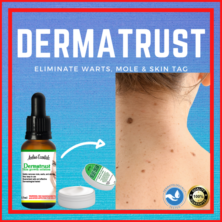 Dermatrust skin growth solution ( Warts remover original / Warts magic ...