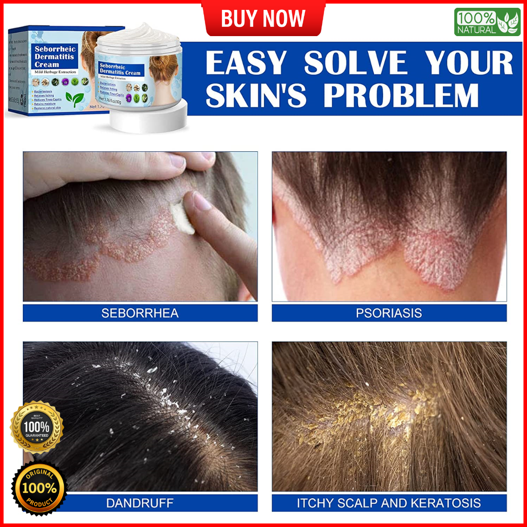 South Moon Seborrheic Dermatitis Cream Antibacterial Cream Anti ...
