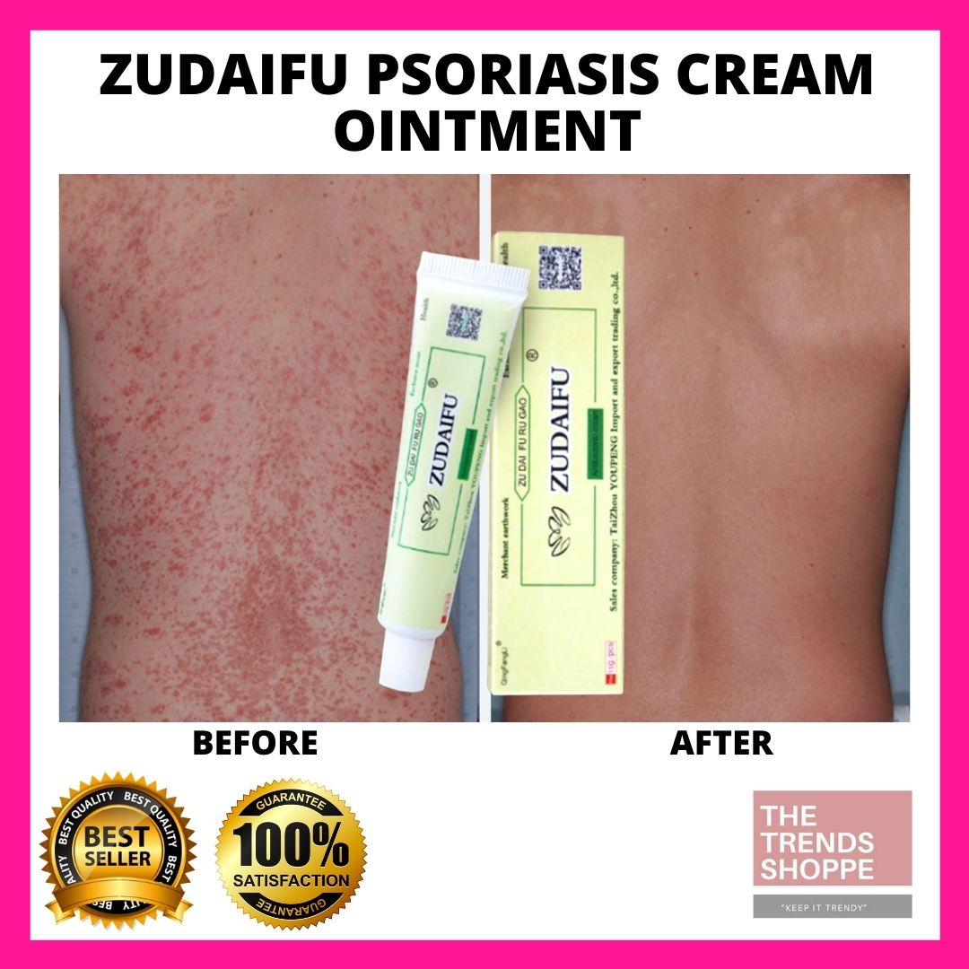 💥The Trends Shoppe - Original Zudaifu Miracle Skin Herbal Psoriasis ...