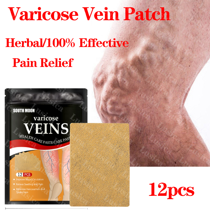 Effective Original Herbal Varicose Vein Patch Natural Varicose Veins ...