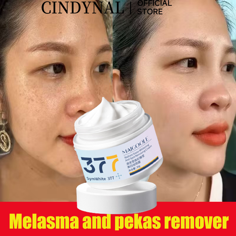 CINDYNAL 377 Melasma Cream Herbal Whitening Freckle Cream Japanese ...