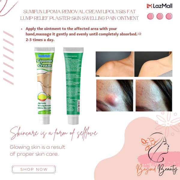 Sumifun Lipoma Removal Cream Lipolysis Fat Lump Relief Plaster Skin ...