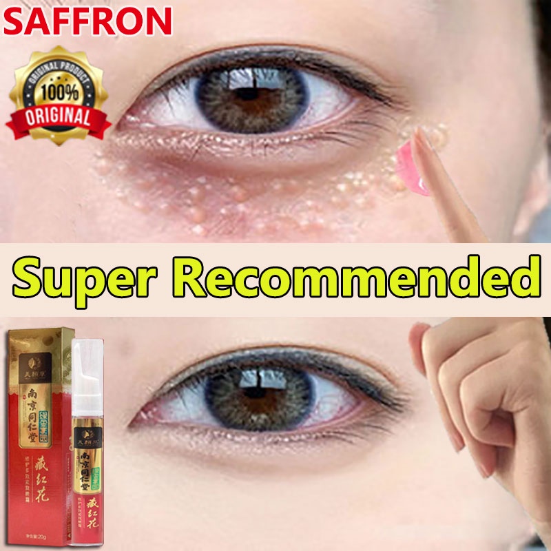 Eye Care Serum 20ml Remove Eye fat Particles and Dark Circles Eye Milia ...
