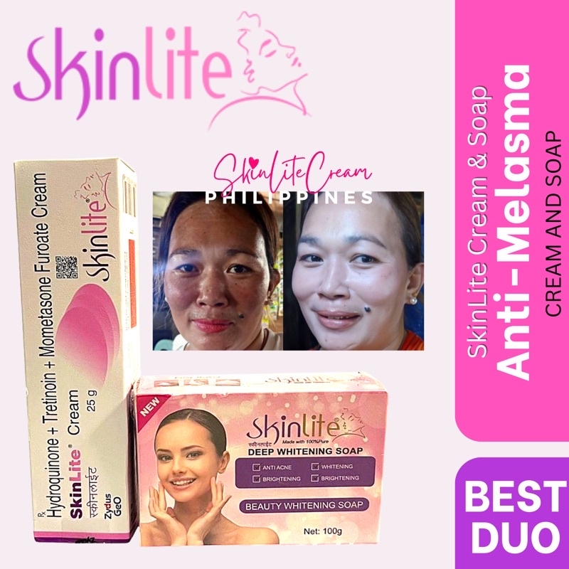 Skinlite Cream Original Duo ( tube cream Soap) | Lazada PH