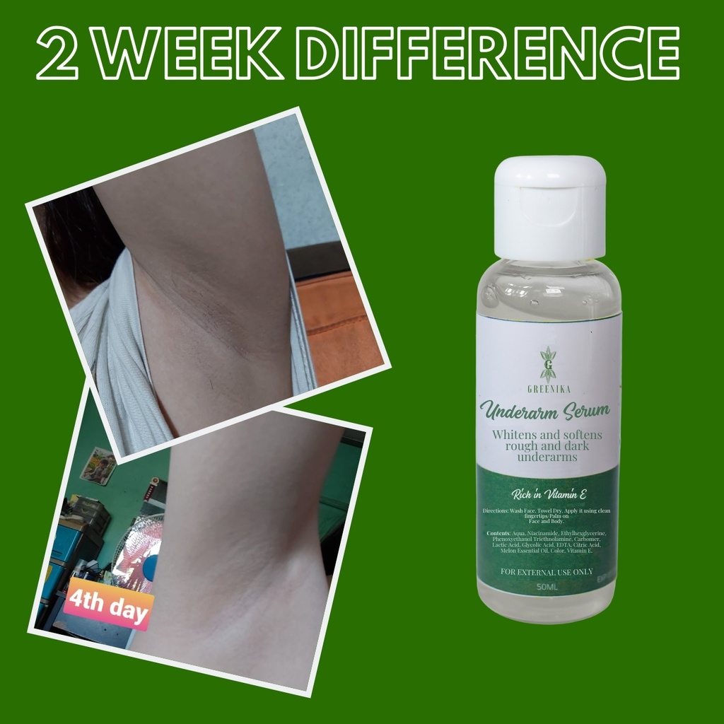 Home Remedy For Armpit Chicken Skin at Angel Stoltz blog