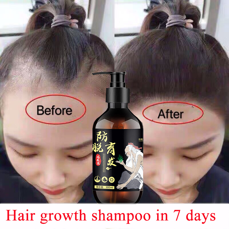 Best Effective Hair Grower Shampoo for Faster, Thicker Hair Growth