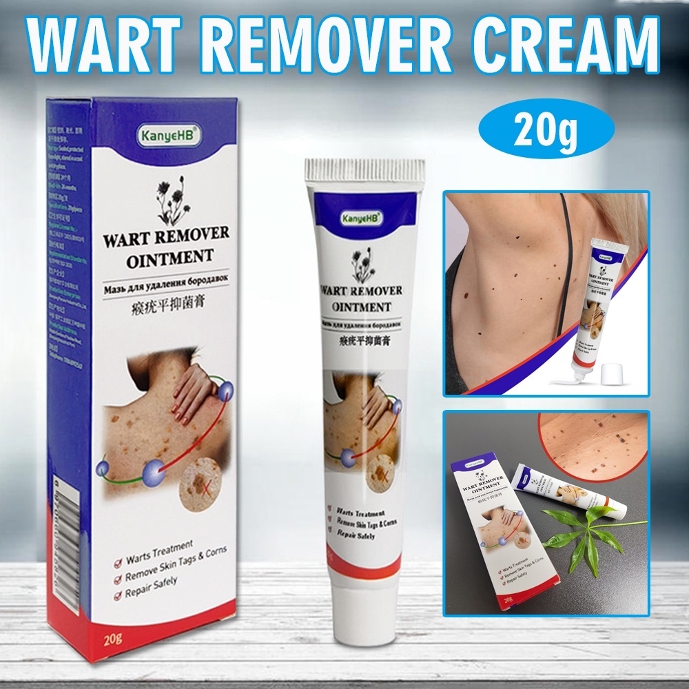 20g Wart Removal Body Warts Treatment Skincare Tag Remover Cream Herbal ...