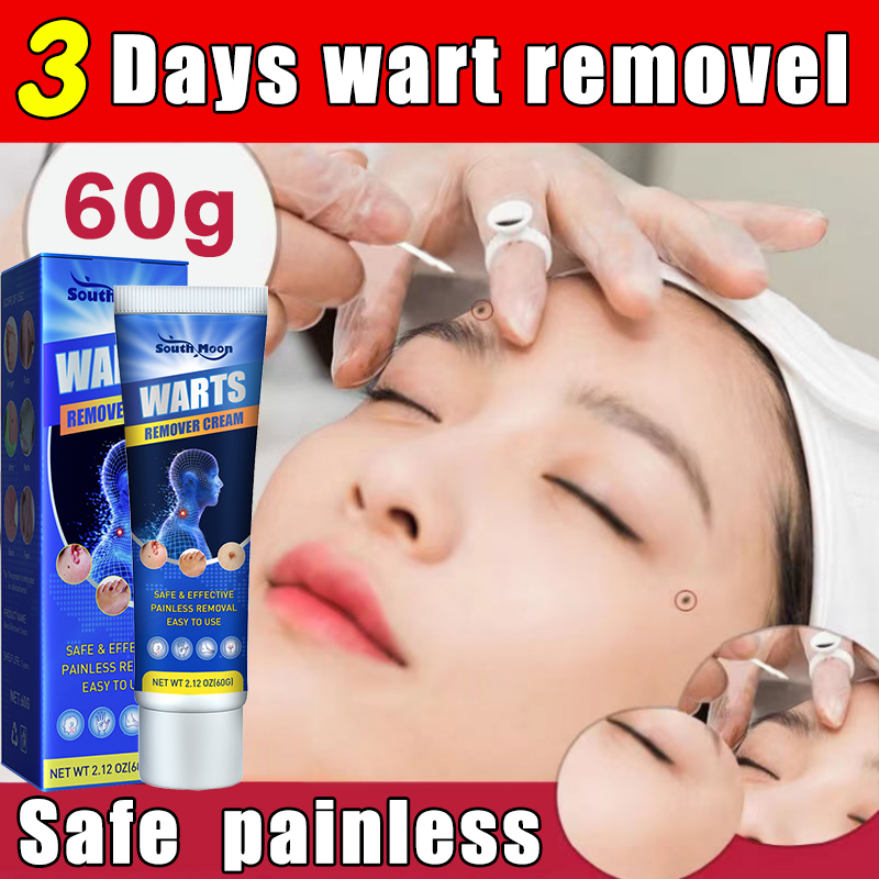 💖Safe Painless💖Warts Remover Cream 60g Wart Removal Ointment Neck Skin Tag Warts Remover ...