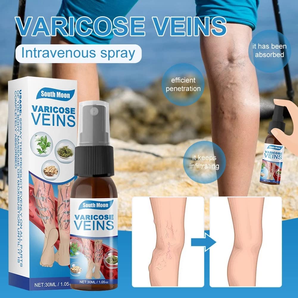 Varicose Veins Miracle Spray Varicose Vein Treatment TOY KING SHOP ...