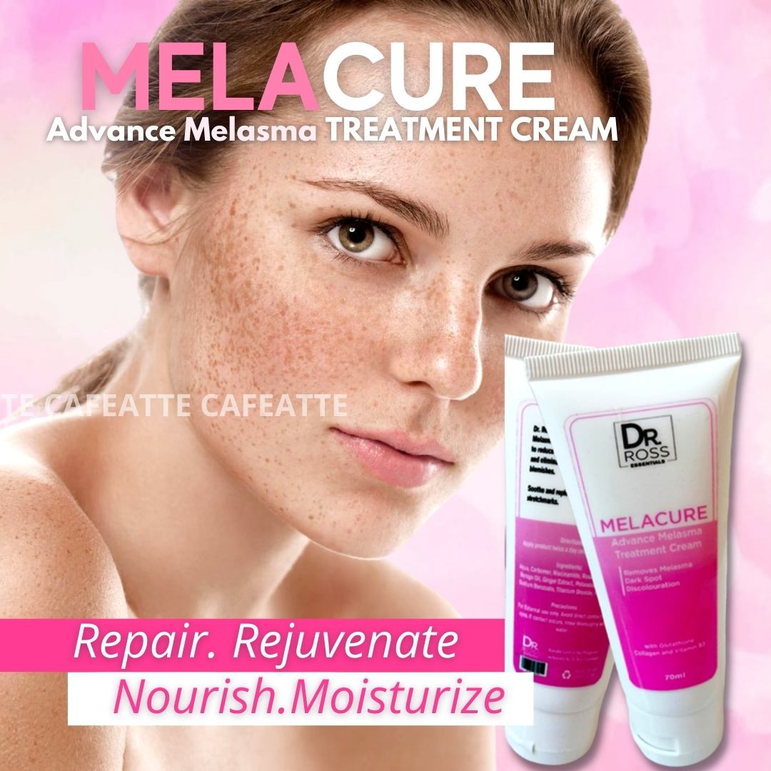 [FOR SKIN PROBLEMS] Melacure Advance Melasma Treatment Cream with ...