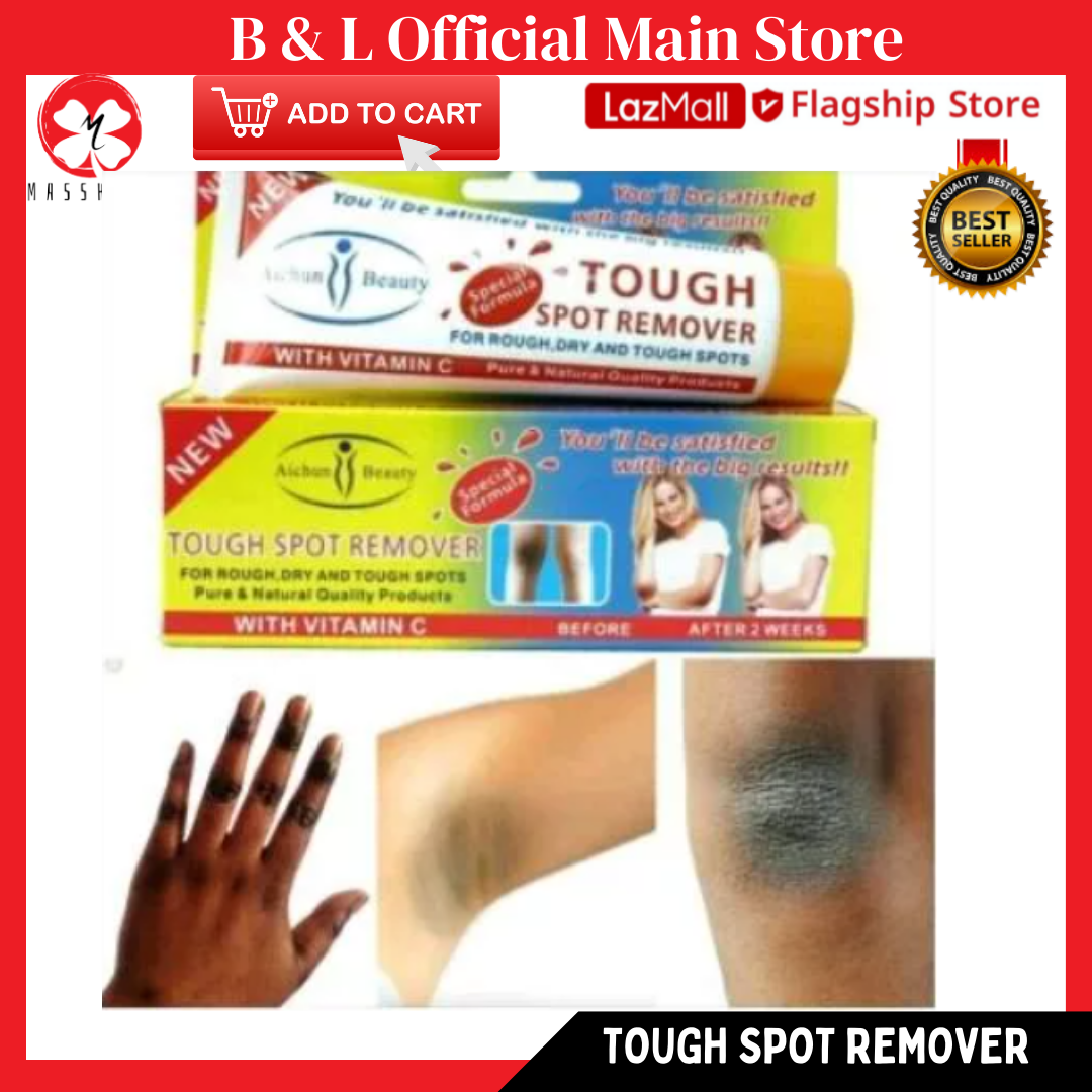 💯Tough Spot Remover with Vitamin C Lightening Cream for Dark Spots ...