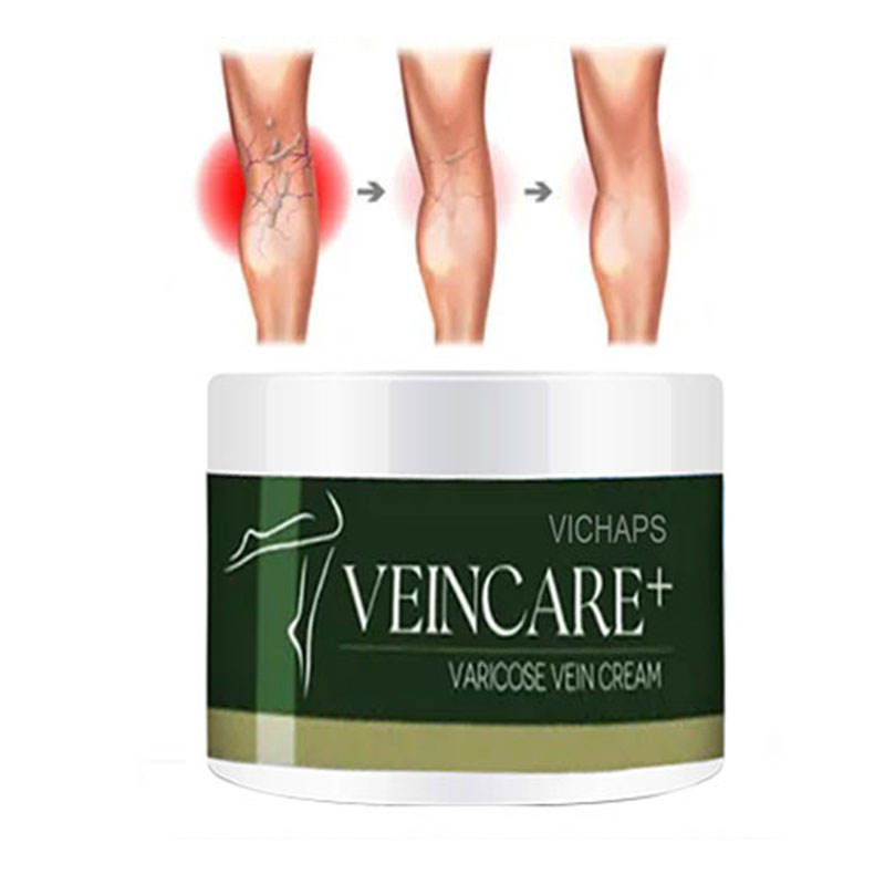Varicose Vein Treatment Cream Remover Original vichaps Varicose Relieve ...