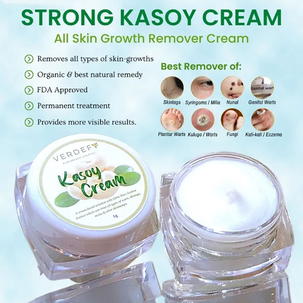 VERDEFY Original Kasoy Oil Cream Removal Warts and Skin Tags Painless ...