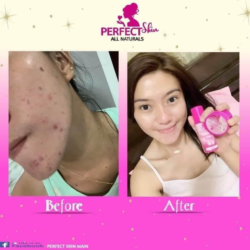 Perfect Skin Rejuvenating Set