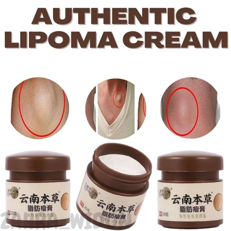 FAST EFFECT!! ON HAND!! Lipoma Removal Cream Treat Tumor Skin Swelling ...
