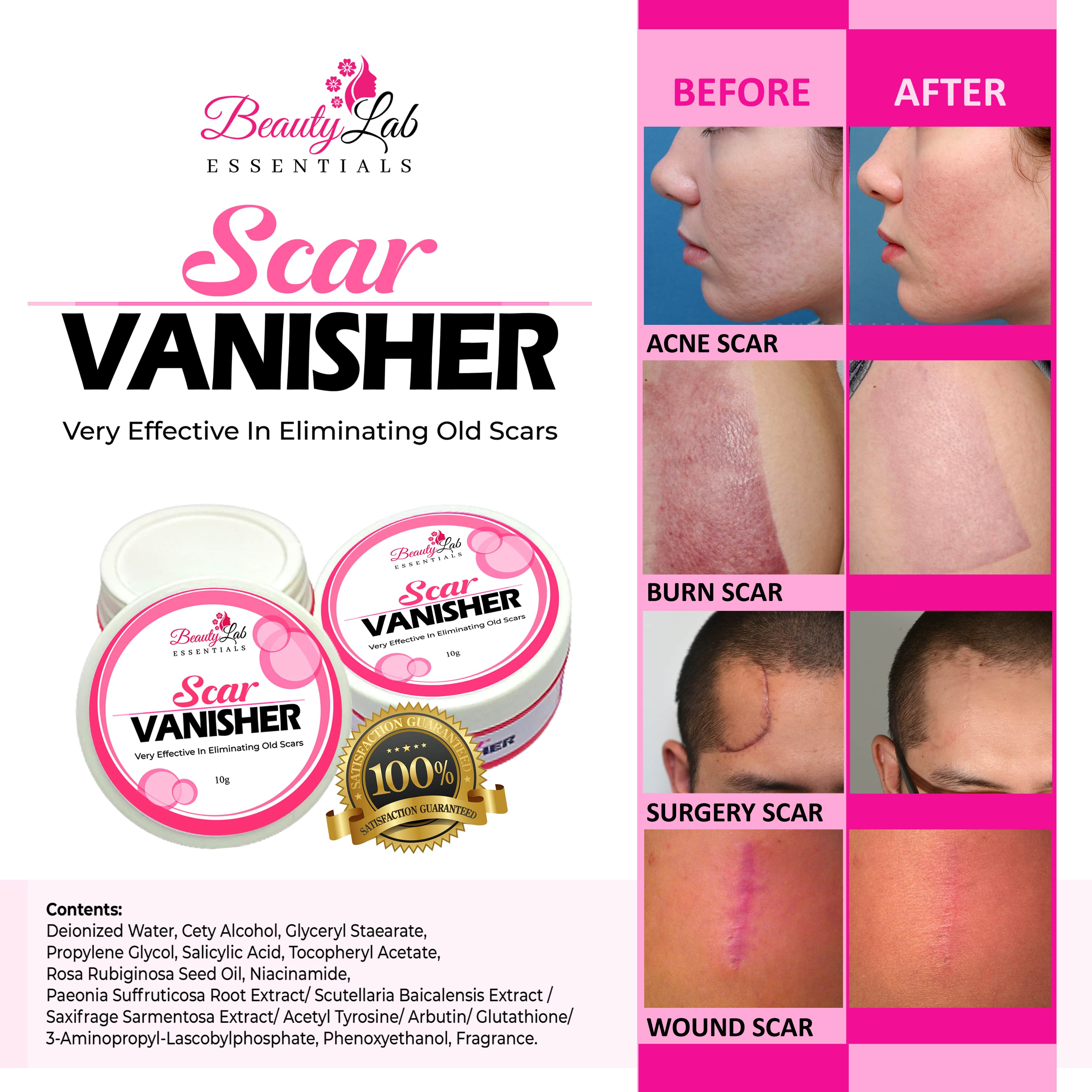 BeatyLab Essentials PH01 Peklat Remover Acne Scar Pimples Mark Dark ...