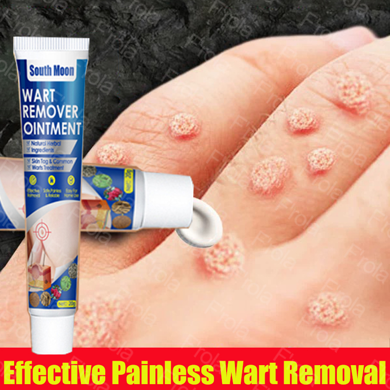 Painless Wart Remover Original Magic Ointment Wart Treatment Cream Skin ...