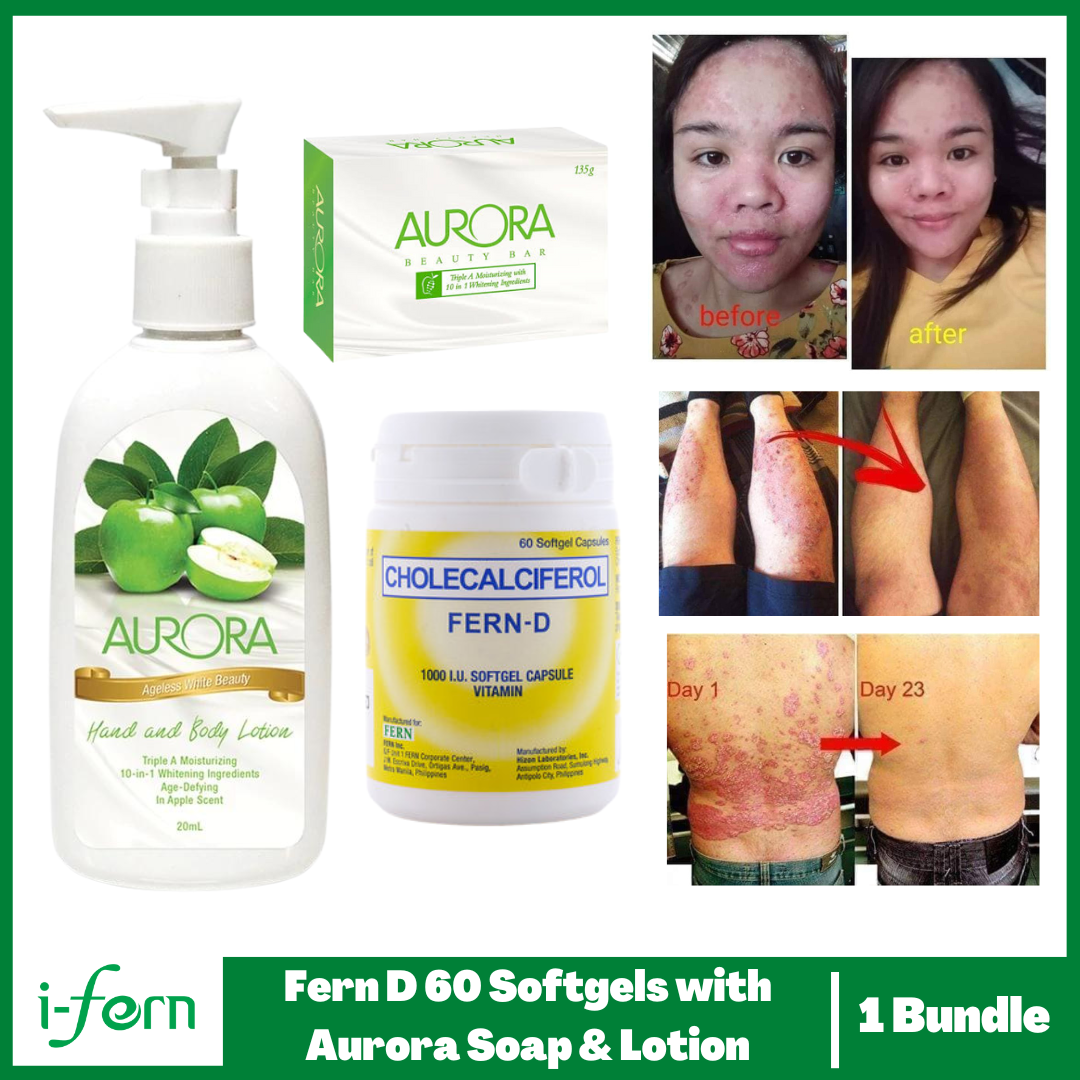 Fern D 60's + Aurora Soap 135g + Aurora Lotion 200ml Treatment for ...