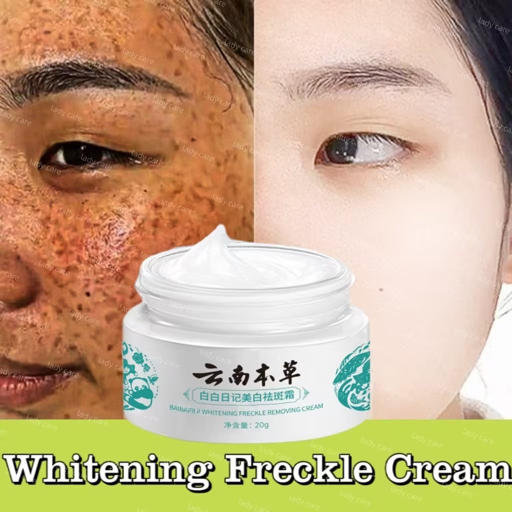 Japanese Melasma Cream Whitening Cream melasma and pekas remover cream ...