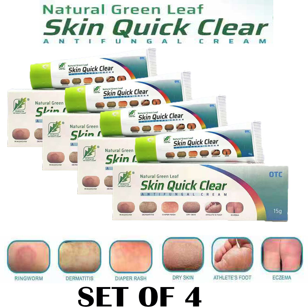 ( SET OF 4 ) Natural Green Leaf Skin Quick Clear Antifungal Cream 15g ...