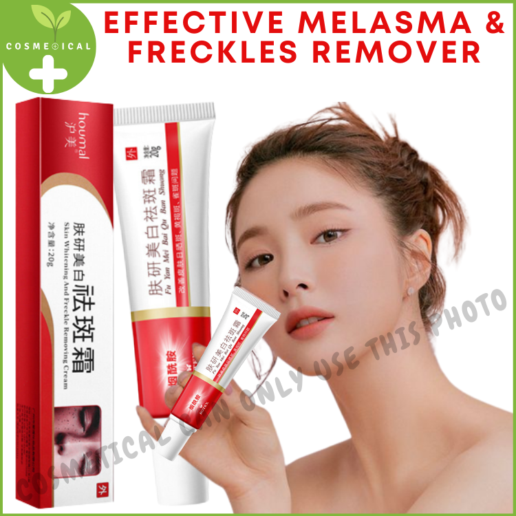Melasma Cream Pekas Remover Collagen Japan Original Pekas Remover Cream ...