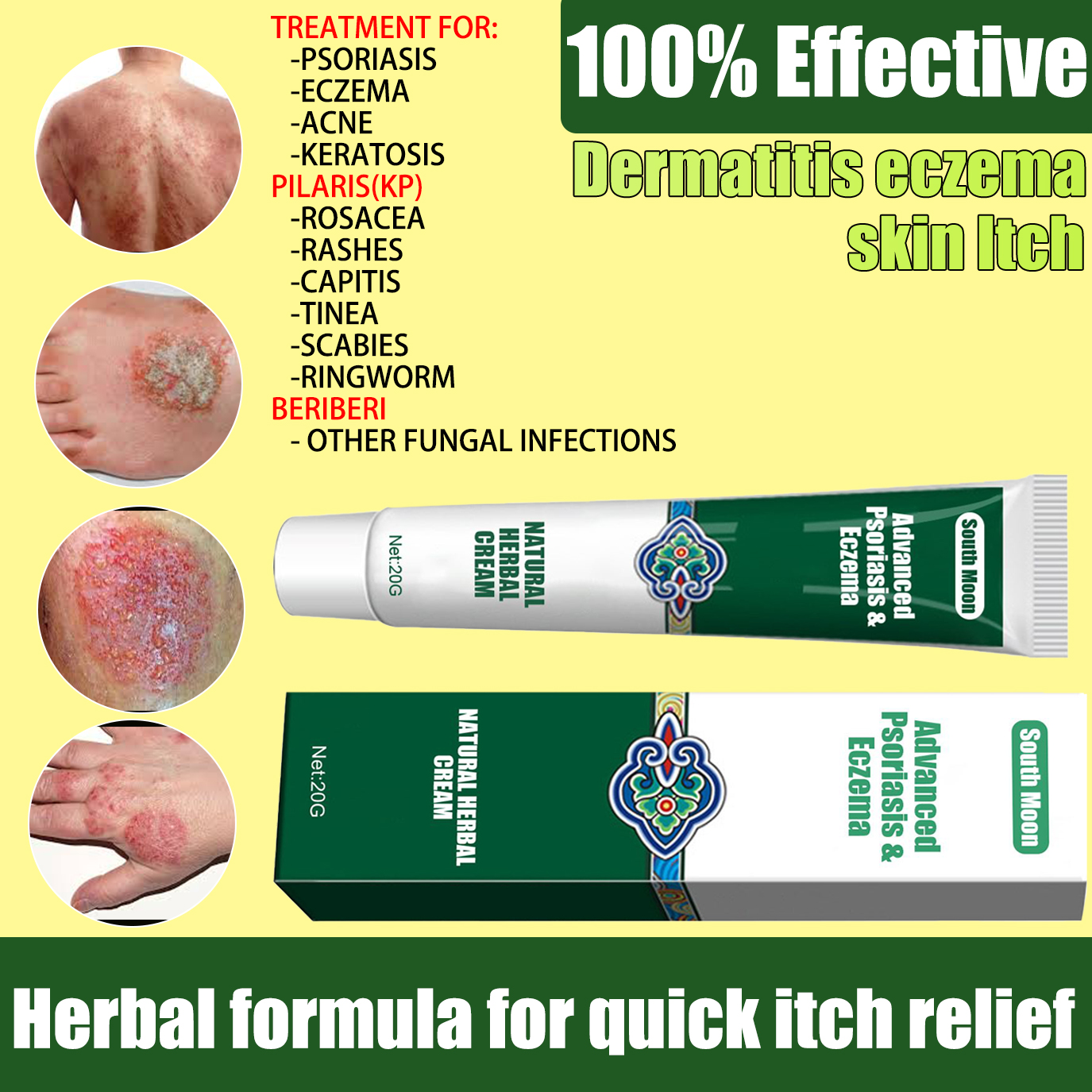 100% Original Natural 20g Herbal Psoriasis Dermatitis Eczema Pruritus ...