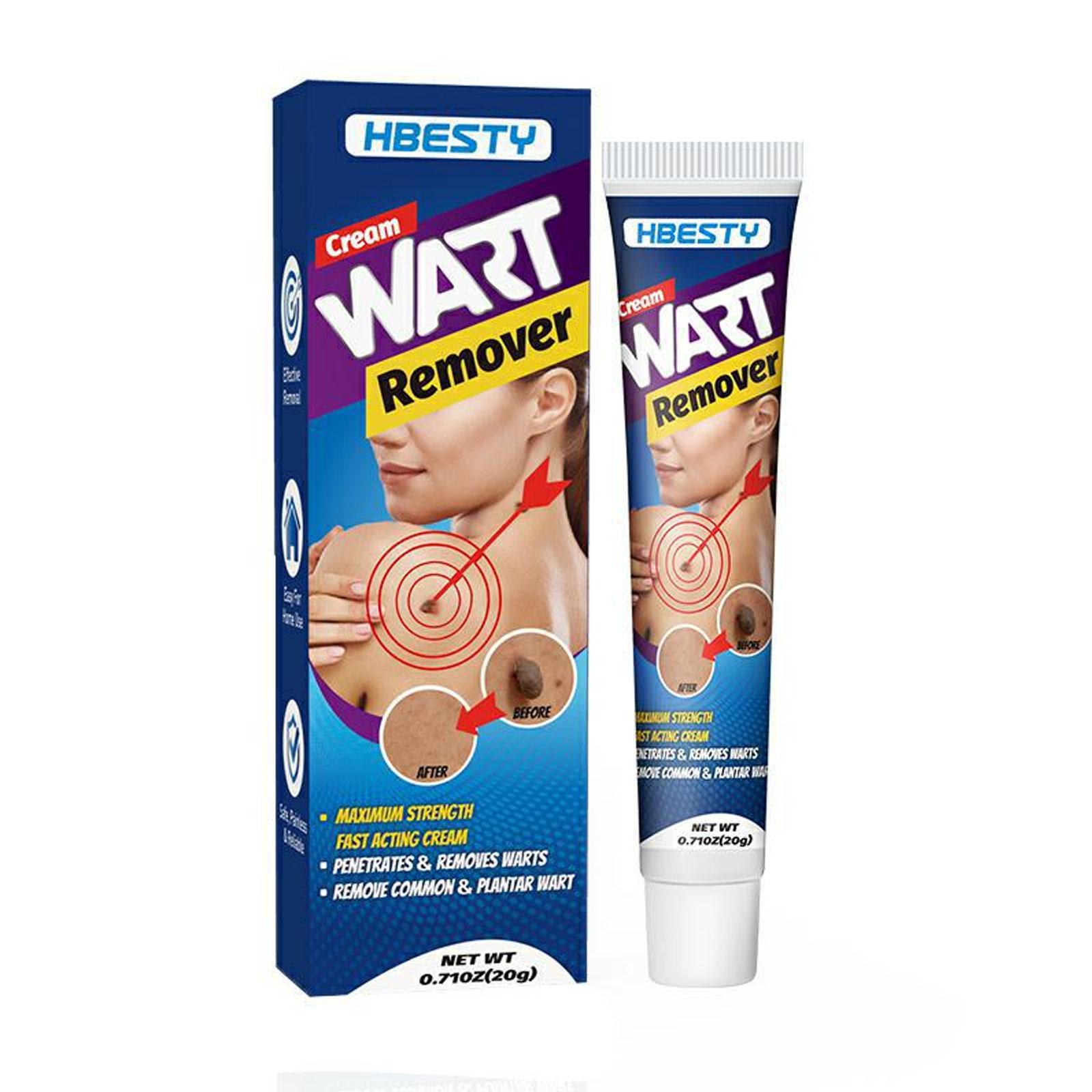HOLD LIVE Wart Remover Cream Warts Magic Remover Wartz Removal Cream ...