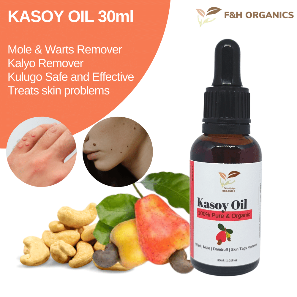 F&H Herbal Pure Kasoy Oil 30ml for Warts Remover, Skin Tags, Keloid ...
