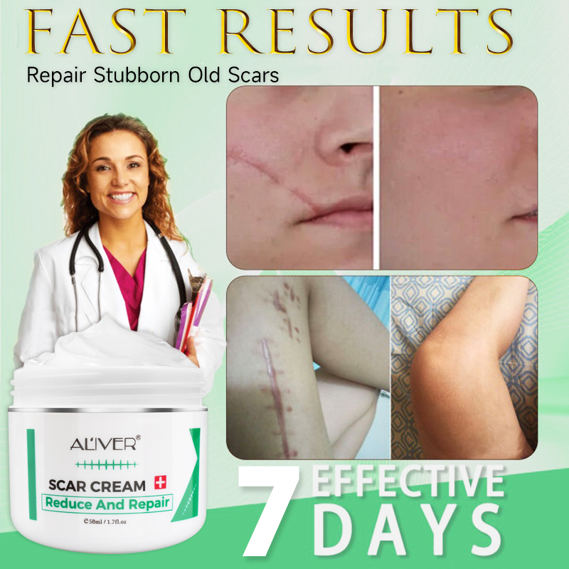 【7Days 100% Effective】Original Aliver Peklat Remover Cream for Old ...