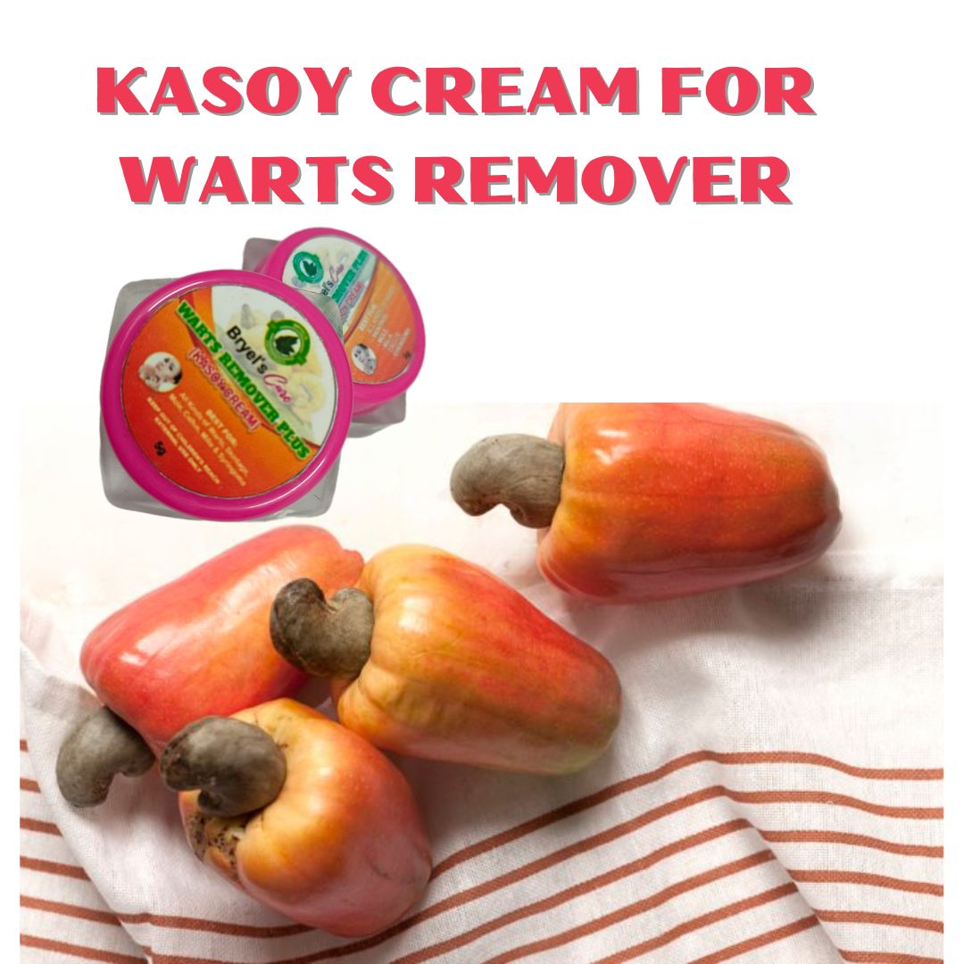 5g Kasoy Cream for Effective Removal of Warts,Moles,Skin Tags and Other ...