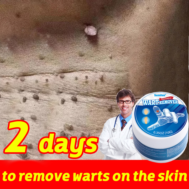 Sumifun 100% Effective Warts Remover Original Warts Magic Remover Wart ...