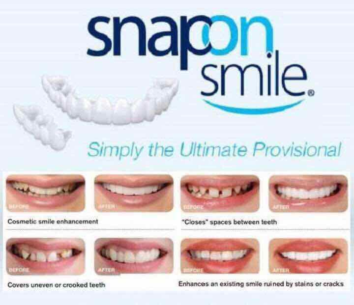 The Original Snap On Smile Teeth One Size Fits Snapon Snap-on Smile ...