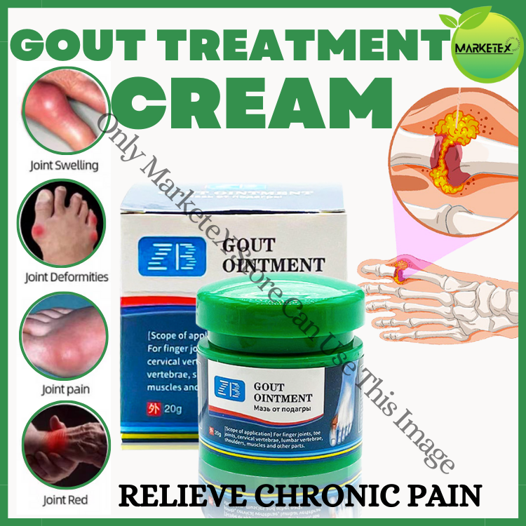 Gout Ointment Treatment Gout Cause Joint Knee Pain Toe Finger Bone Spur ...