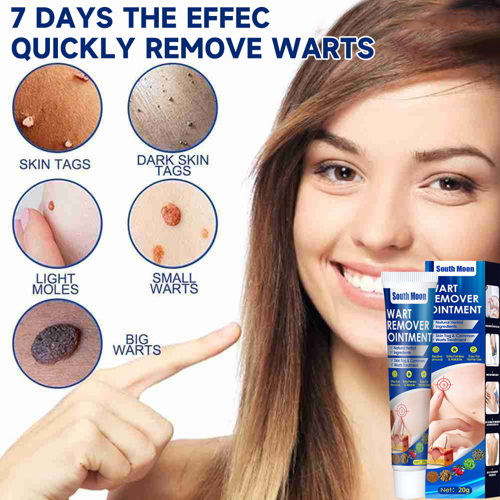 【South Moon】Warts Remover Original Cream Warts Magic Remover Warts ...